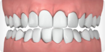 Common Problems - Sound Orthodontics